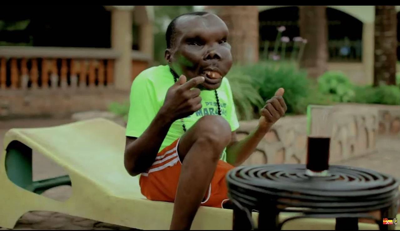 People Recognized by Guinness for Unique Physical Traits
